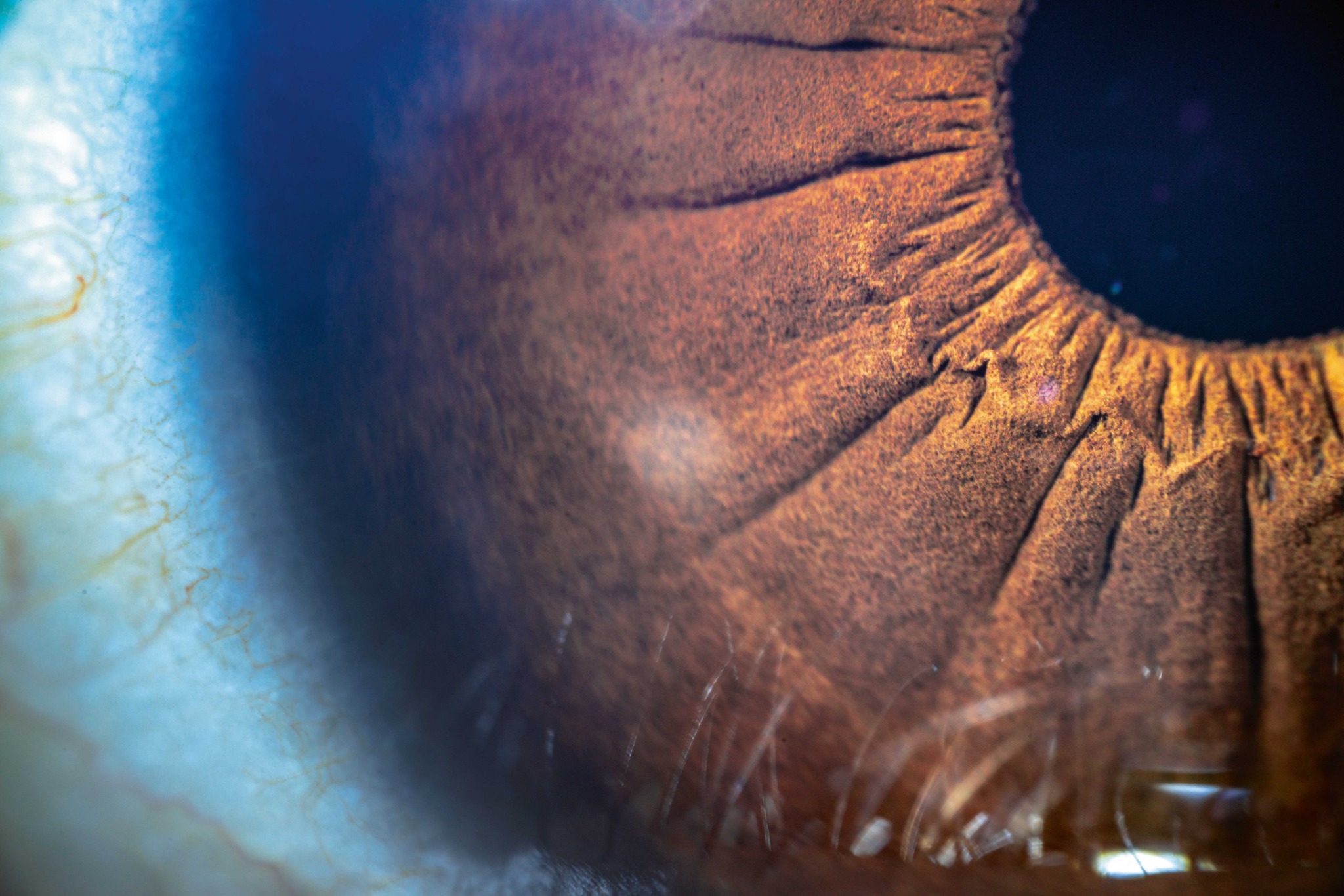 For 100,000 eyes. Micro-precision in series - Mitsubishi Electric EDM